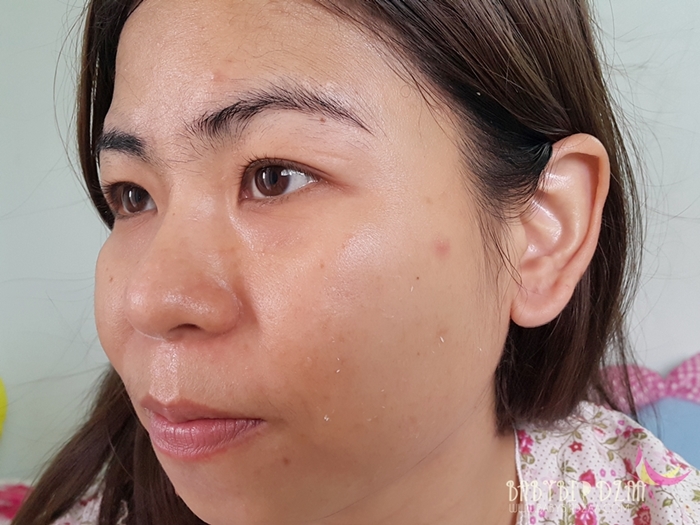 [Review] Dermalis Derma Booster Mask มาส์คหน้าเพื่อผิวขาวกระจ่างใสเพียง ...
