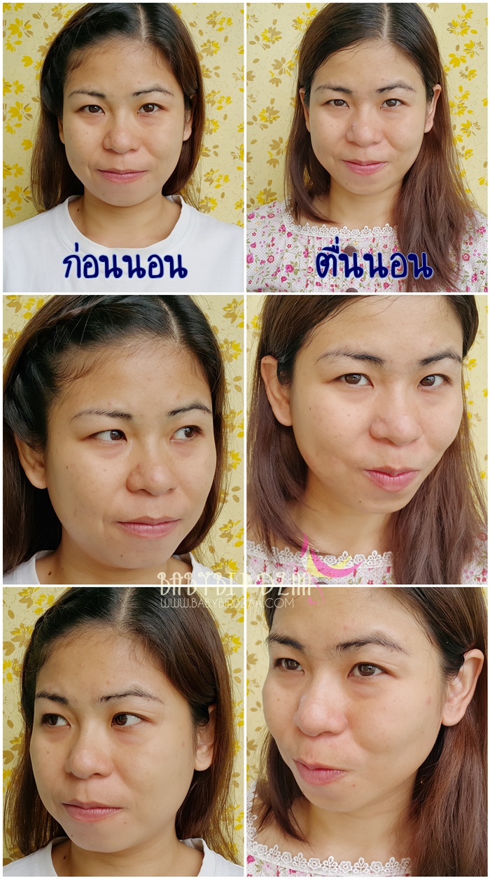 [Review] Dermalis Derma Booster Mask มาส์คหน้าเพื่อผิวขาวกระจ่างใสเพียง ...