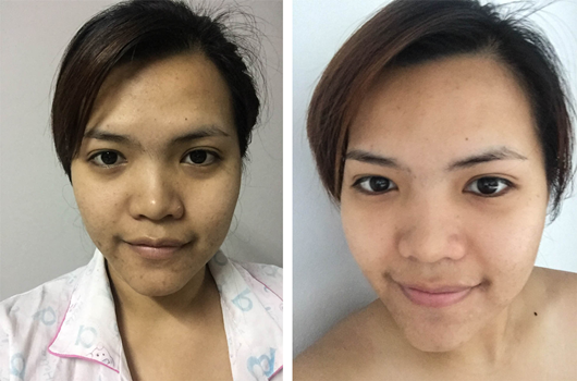 [REVIEW]: Dermalis Derma Booster Mask >>> เผยผิวกระจ่างใสเพียงข้ามคืน