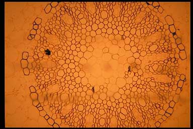 Root cells & Culture