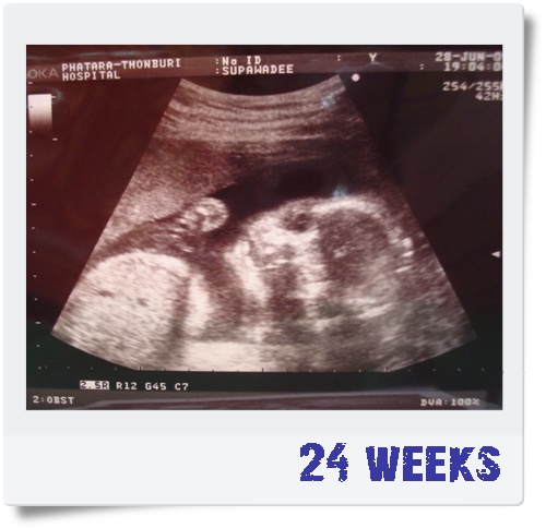 24 weeks ได้รู้ว่าเขาครบแข็งแรง ก็ดีใจแล้ว