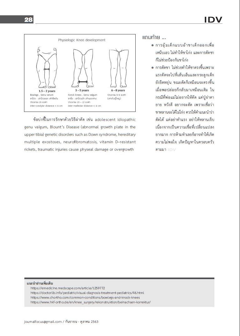 BlogGang.com : : หมอหมู - Lower Extremity Alignment: Genu Varum ...