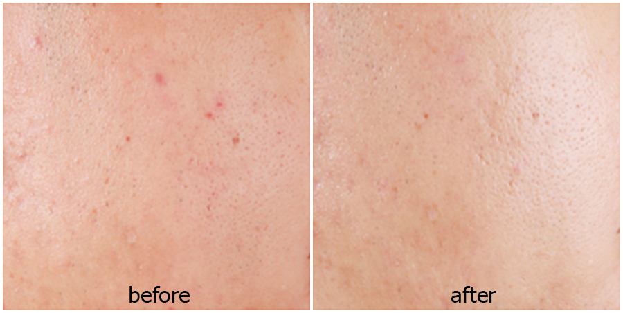 รีวิว คืน 5 สัญญาณผิวสวยสุขภาพดีกับ ผลิตภัณฑ์เวชสำอาง Dermalis skincare
