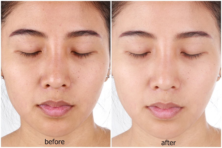 รีวิว คืน 5 สัญญาณผิวสวยสุขภาพดีกับ ผลิตภัณฑ์เวชสำอาง Dermalis skincare