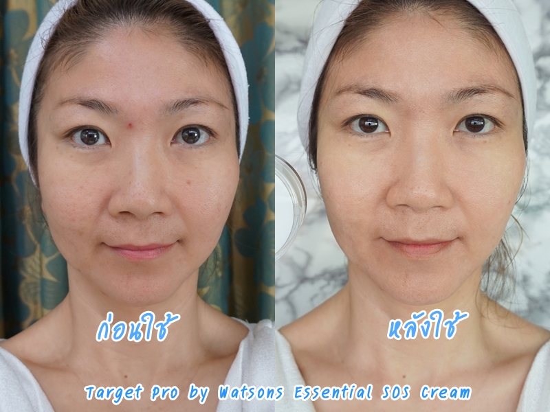 ฟื้นฟูผิวผิวแห้งเสีย ขาดการบำรุง ด้วยครีมบำรุงสูตรเข้มข้น Target Pro by ...