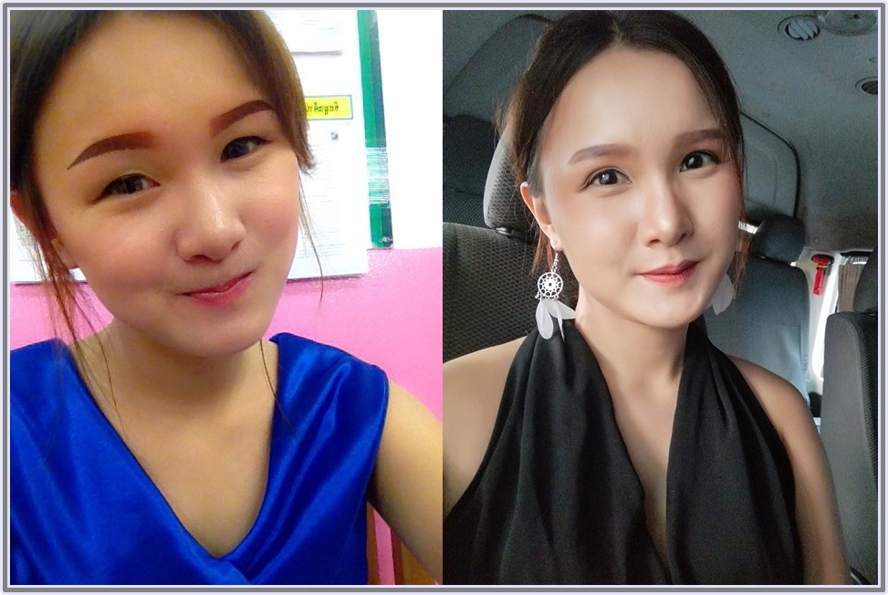 Bloggang.com : สมาชิกหมายเลข 4662358 - รีวิวทำตา2ชั้น @SLC