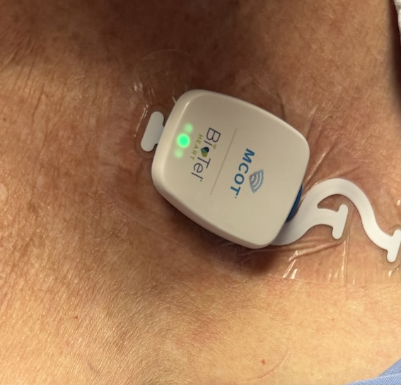 หมอให้ใส่เครื่องตรวจคลื่นหัวใจ / Phillips Mobile Cardiac Telemetry