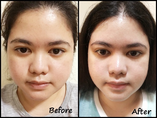 [Review] Lavita Anti-Melasma Spot Serum เซรั่มลดฝ้า