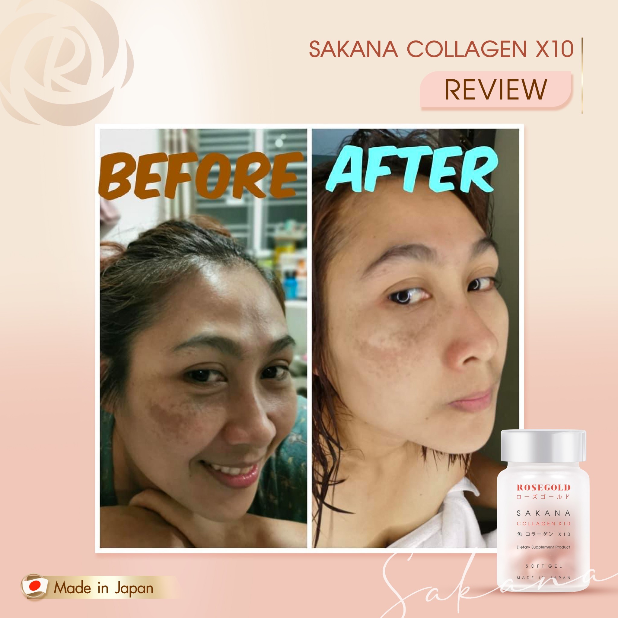 รีวิว Sakana Collagen x10 อาหารผิวที่แม่ชมเลือก