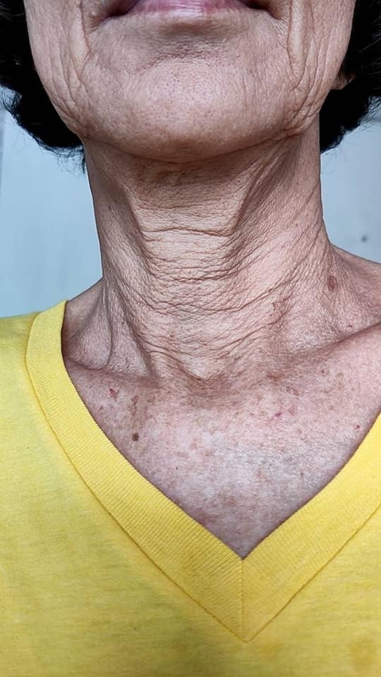 Swan Lift ความสวยนี้เพื่อแม่