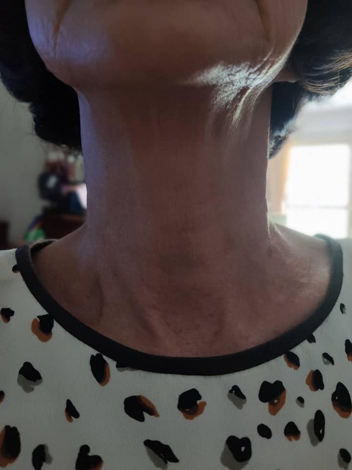 Swan Lift ความสวยนี้เพื่อแม่