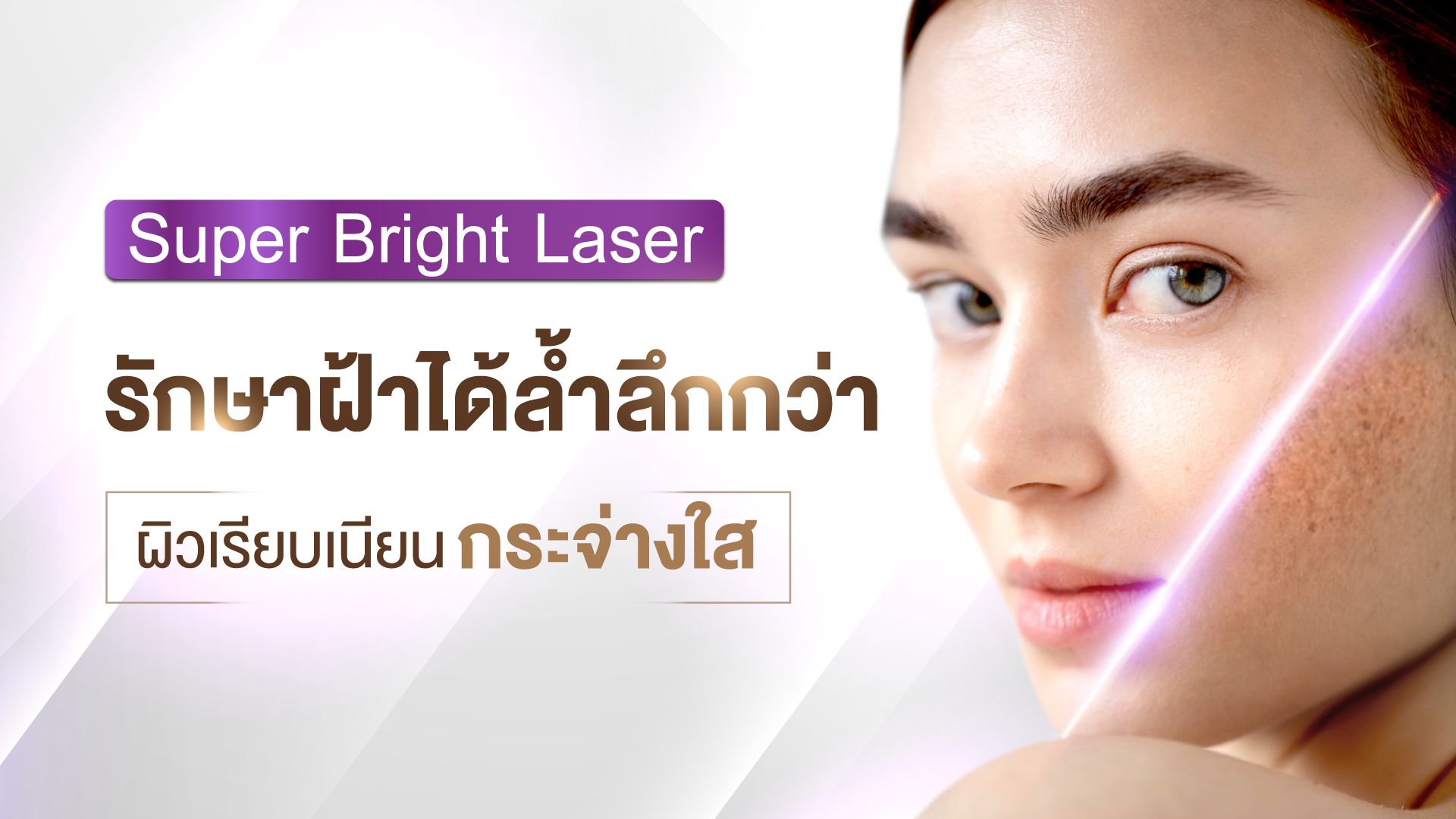 Super Bright Laser รักษาฝ้าได้ล้ำลึกกว่า ผิวเรียบเนียน กระจ่างใส