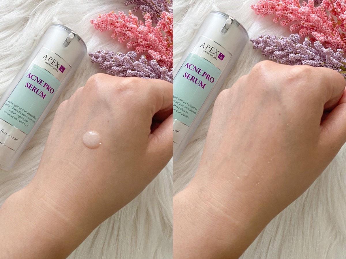 จบปัญหาสิวด้วย ACNE PRO SERUM ใช้ทุกวันผิวกระจ่างใสจริง