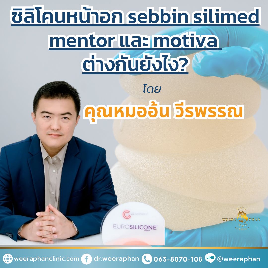 ซิลิโคนหน้าอก sebbin silimed mentor และ motiva ต่างกันอย่างไง