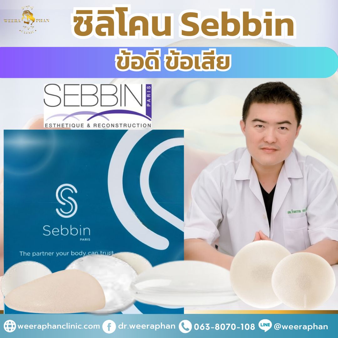 ซิลิโคน sebbin ข้อดี ข้อเสีย